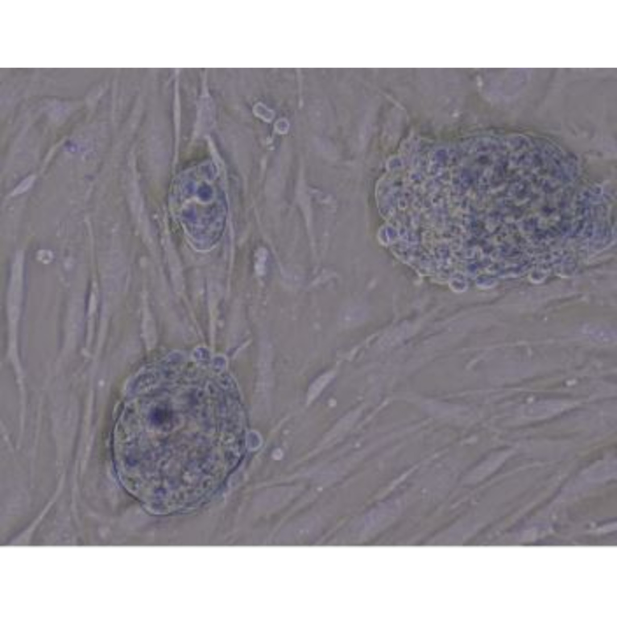Evident Olympus Inverted Microscope Olympus Ckx53 Ipc Ivc V1 Ph Trino
